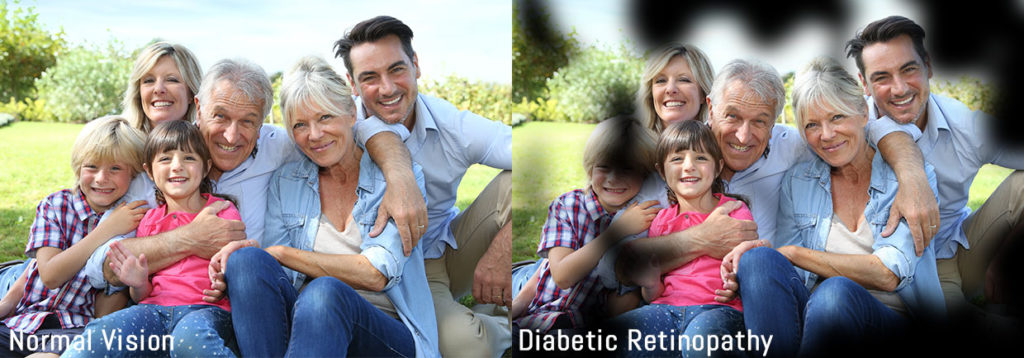 diabetic-ret-example - Eye Physicians, PC (Nebraska)